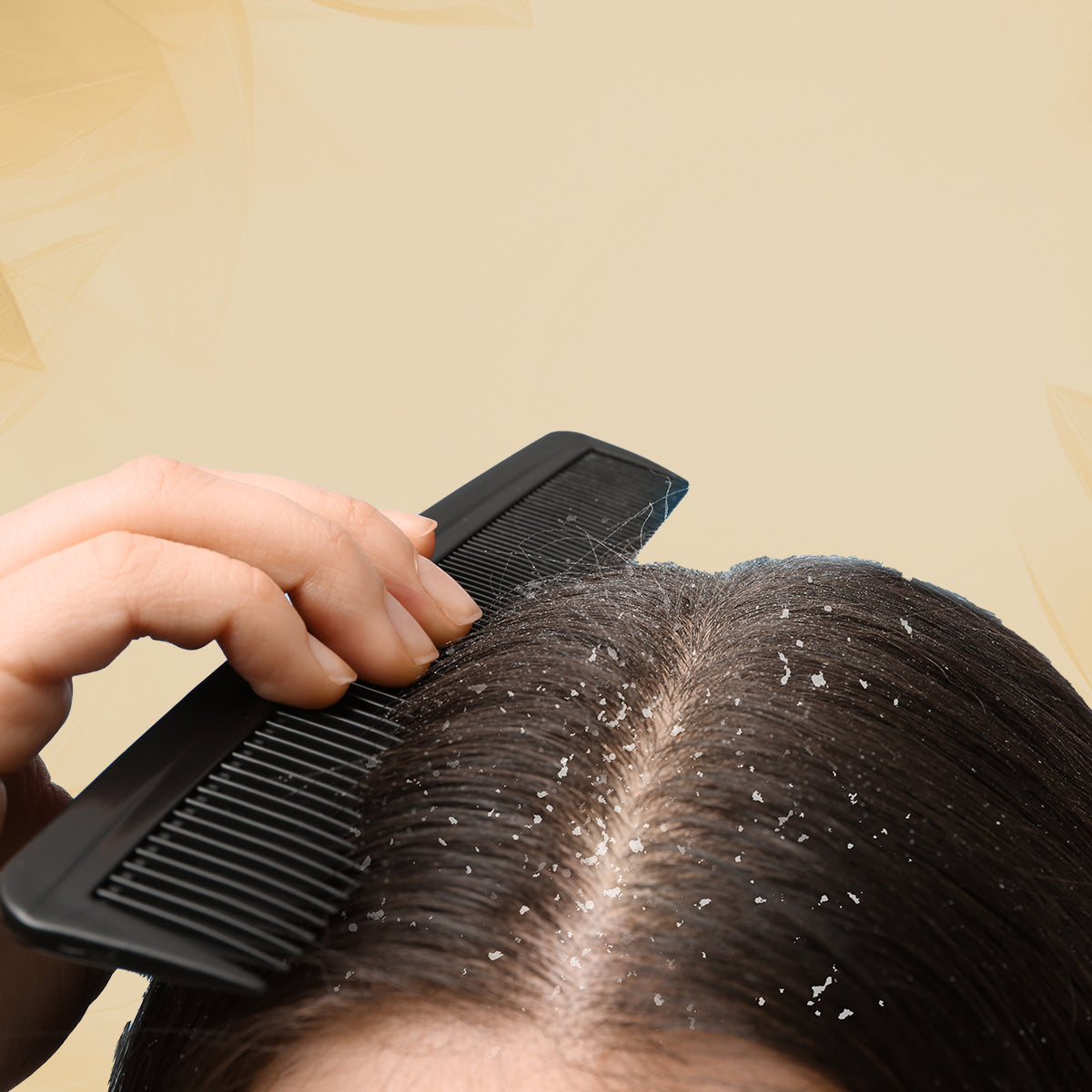 Best Dandruff Care Products | Flake-Free & Healthy Scalp Solutions ...